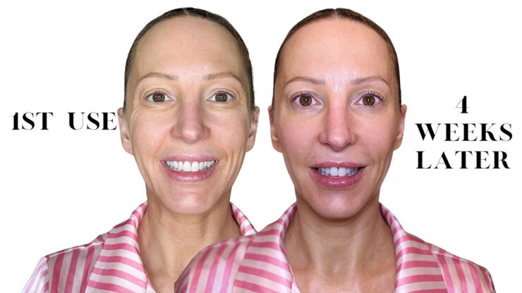 ZIIP Halo review | Does the Microcurrent and Nanocurrent™ beauty device ...