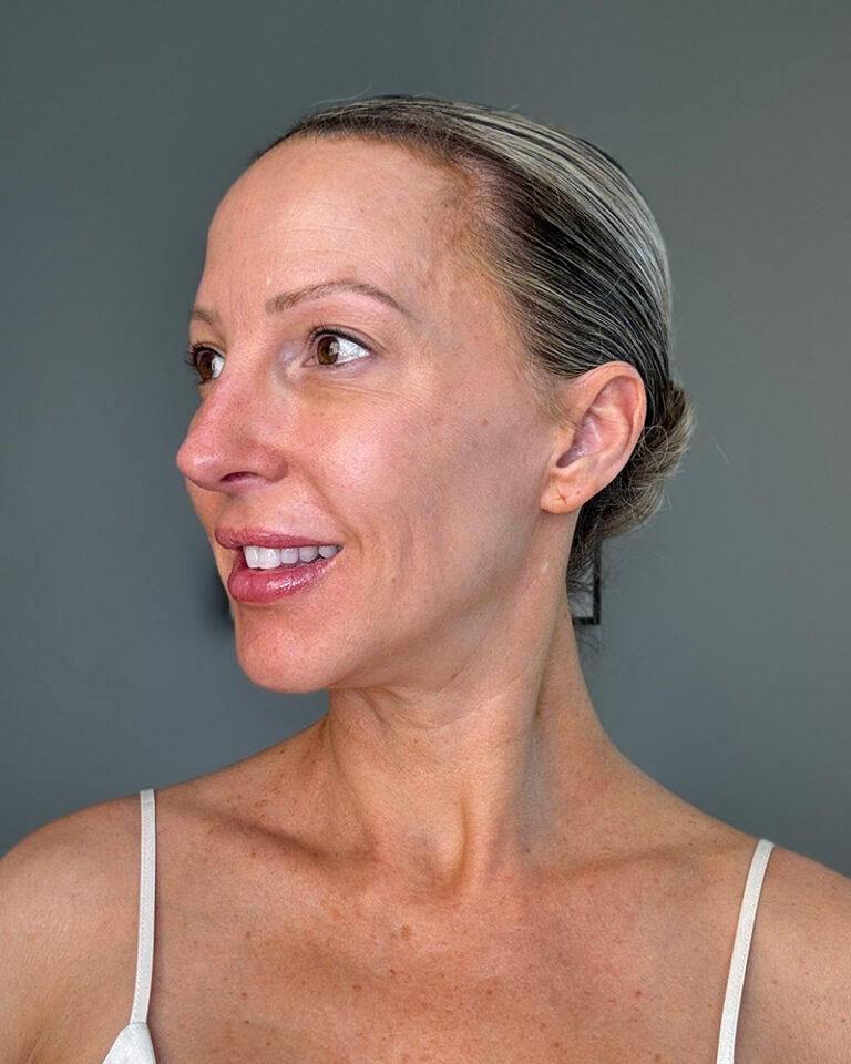 LED Esthetics Glotech review: Best red light therapy mask? - Glamour ...