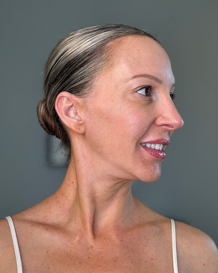 LED Esthetics Glotech review: Best red light therapy mask? - Glamour ...