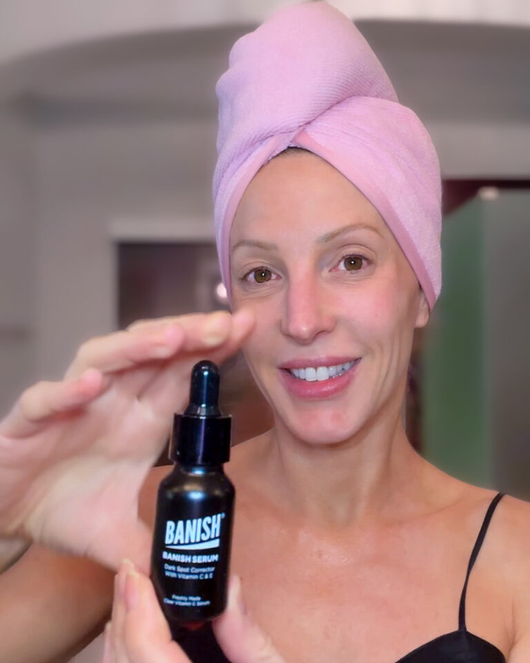 Banish Kit 3.0 Review: At-Home Microneedling with 18 Months of Real ...