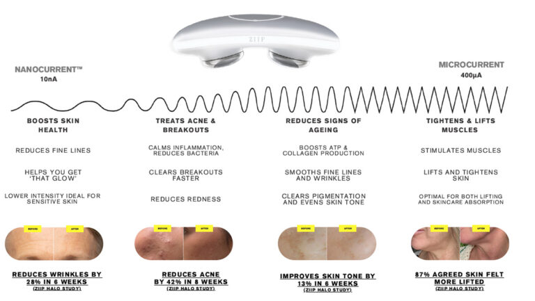 Best Microcurrent Device 2026: Why ZIIP Halo 2.0 Wins vs NuFACE ...